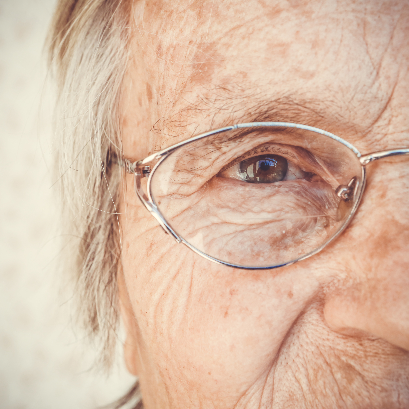 Aging / Sun Damaged Skin - English Dermatology