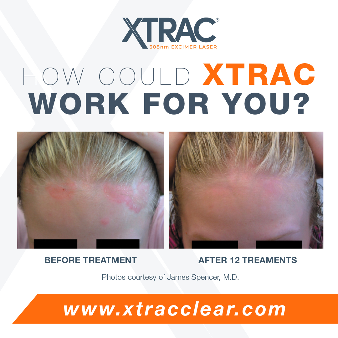XTRAC Laser - English Dermatology